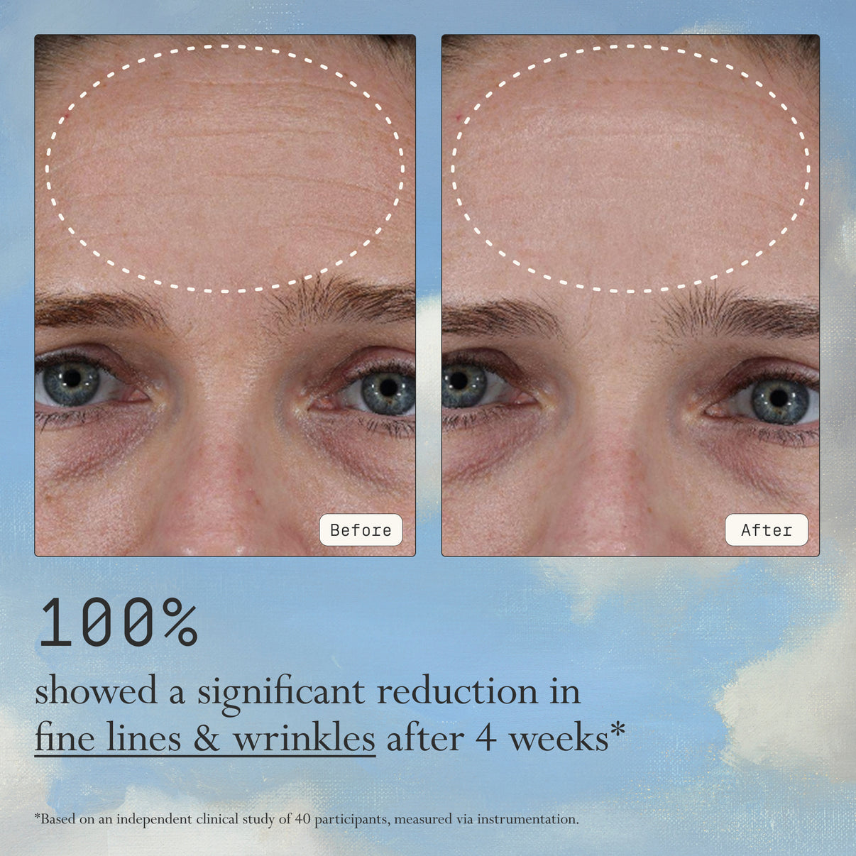 Instant Angel Moisturizer | Lipid-Rich, Nourishing Face Cream | Dieux