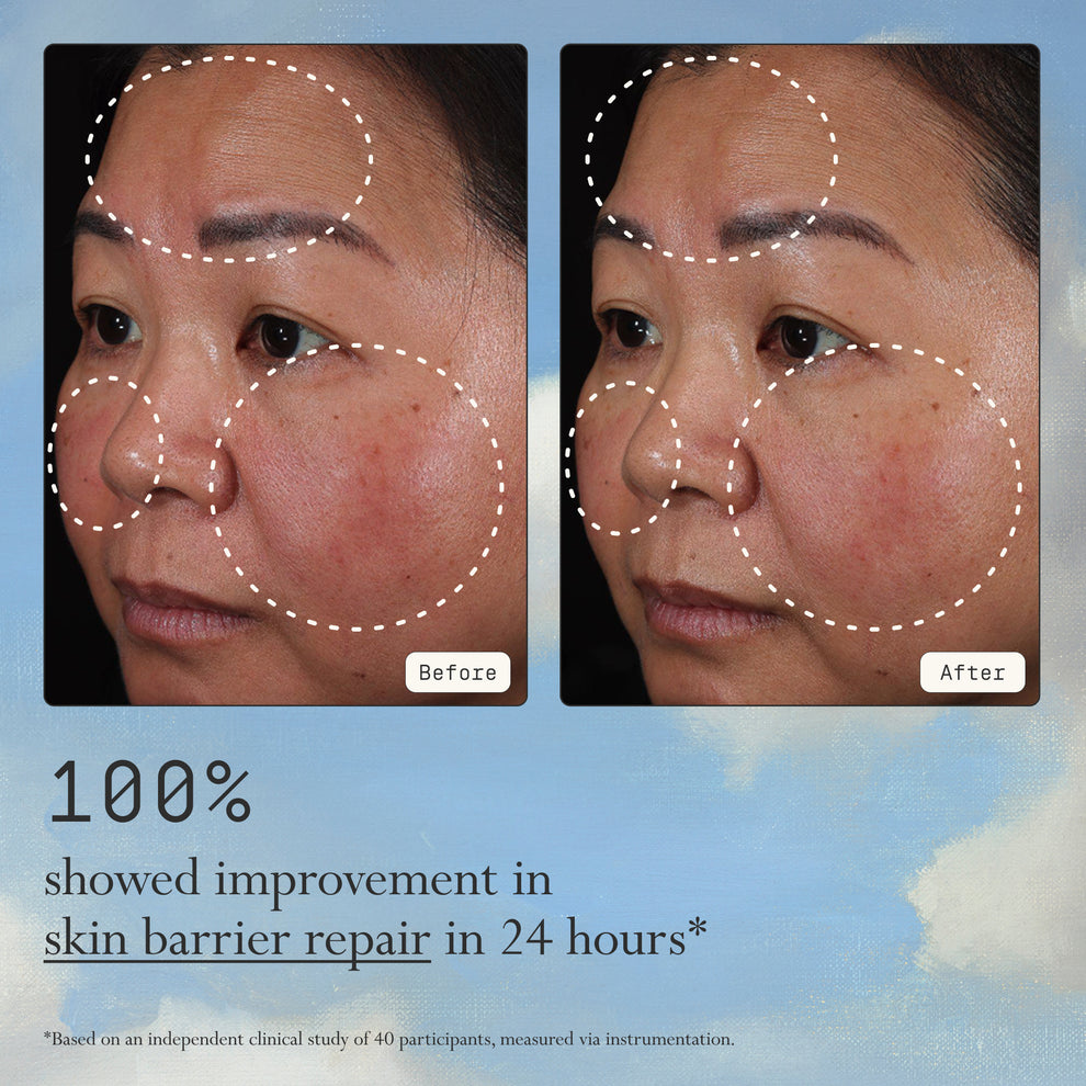 Instant Angel Moisturizer | Lipid-Rich, Nourishing Face Cream | Dieux